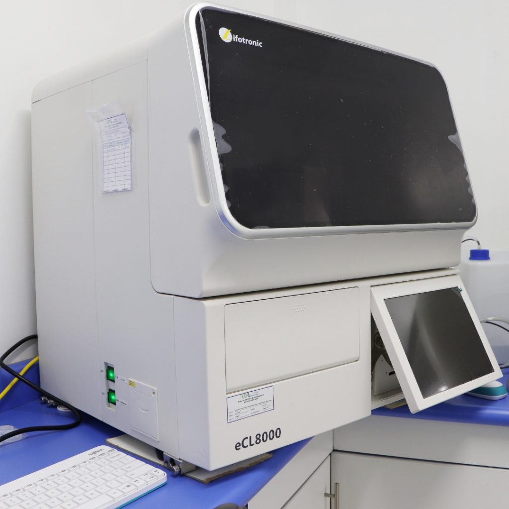 Analizador de electroquimioluminiscencia (ECLIA): eCL8000 (LIFOTRONIC ...