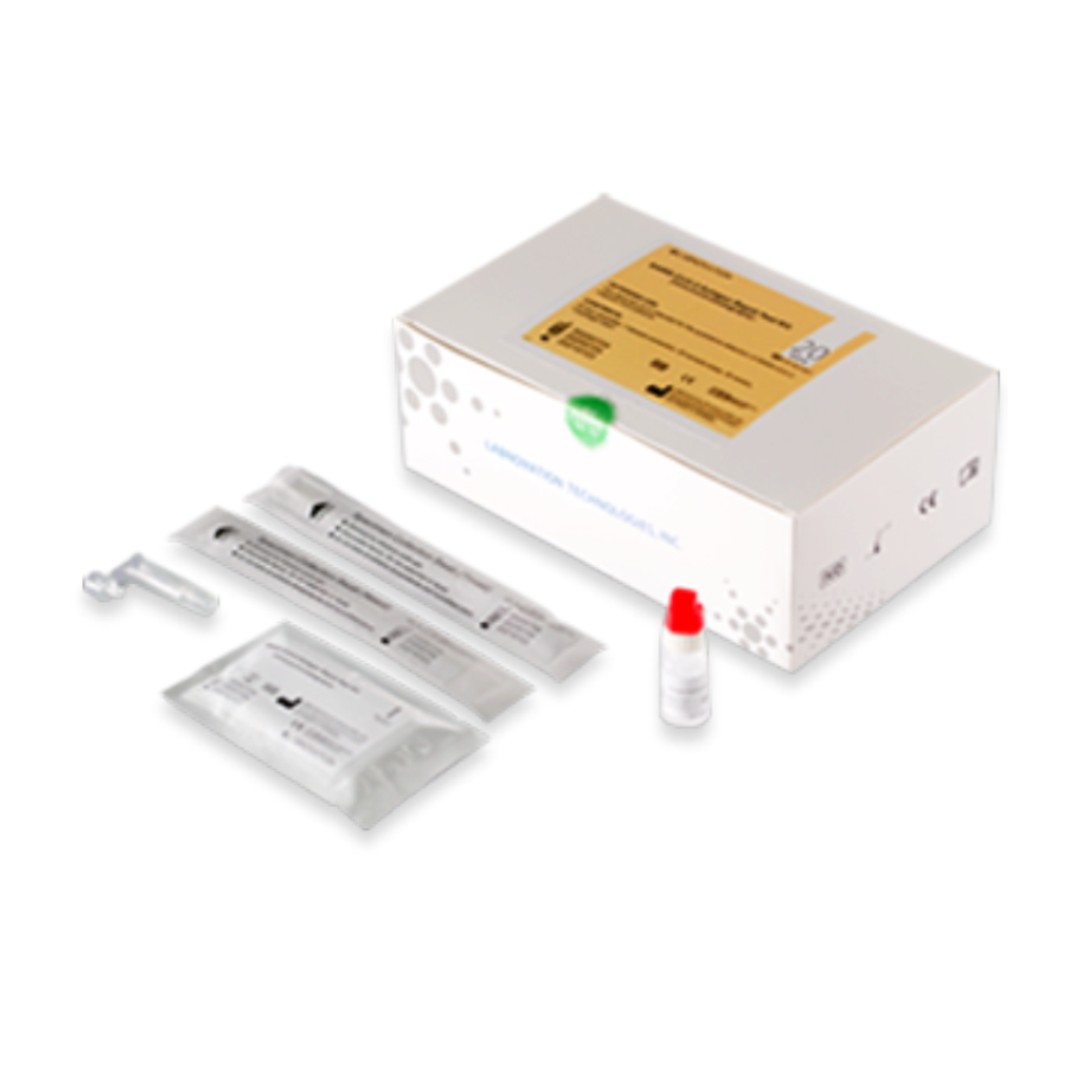 Analizador de electroquimioluminiscencia (ECLIA): eCL8000 – LHS Perú